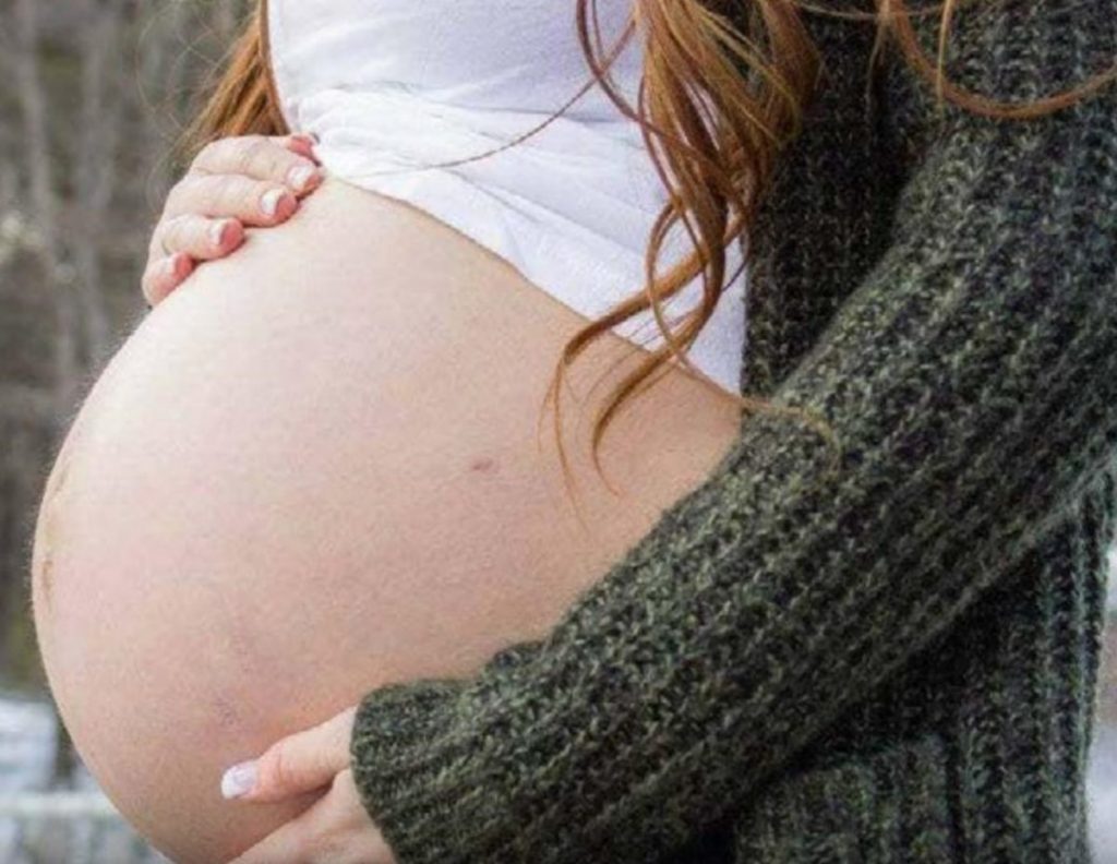 Pregnancy Scar Fetal Health Foundation pregnancy-scar-fetal-health-foundation
