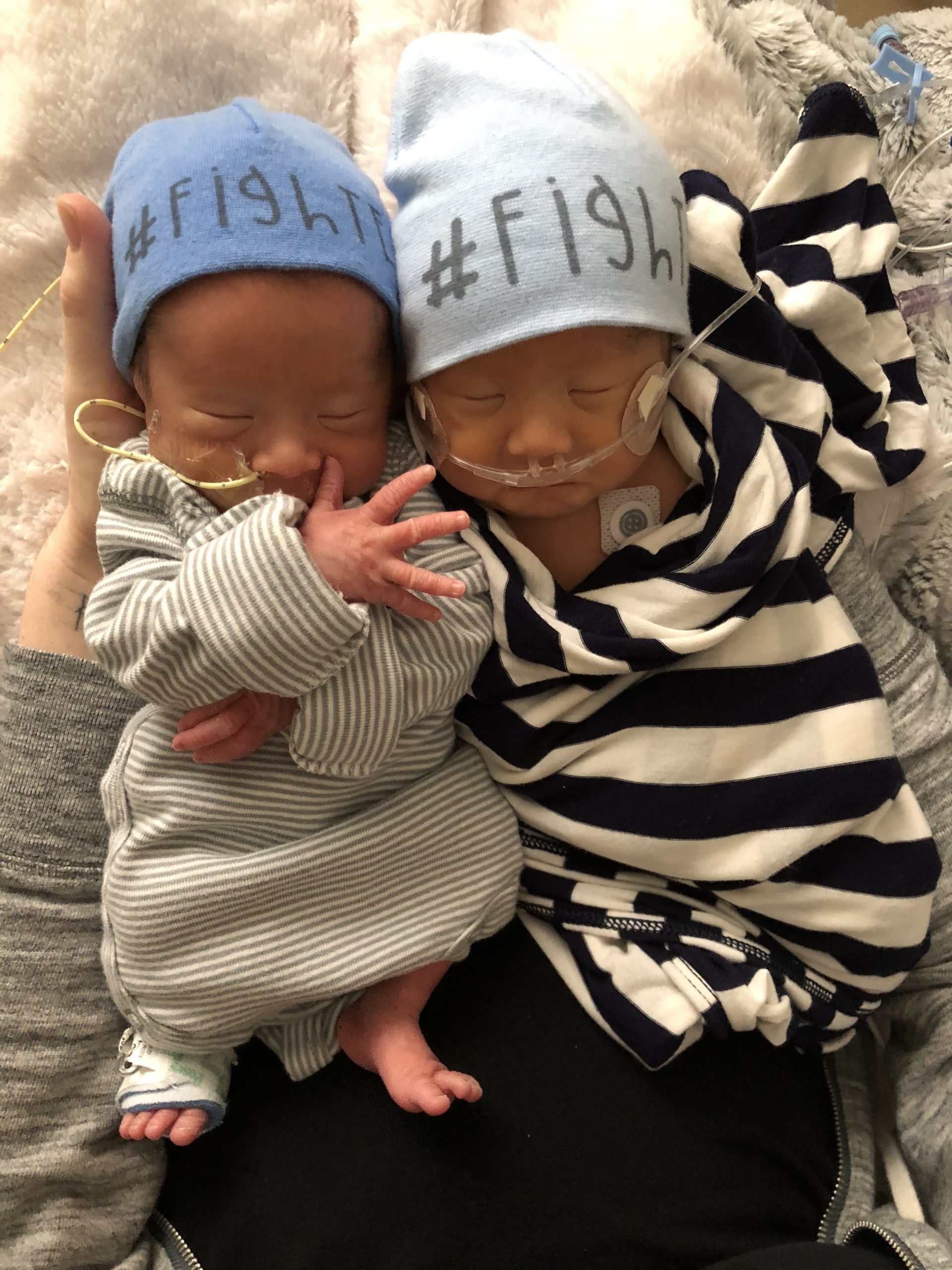 How Mono-Mono Twins Overcame Incredible Hurdles