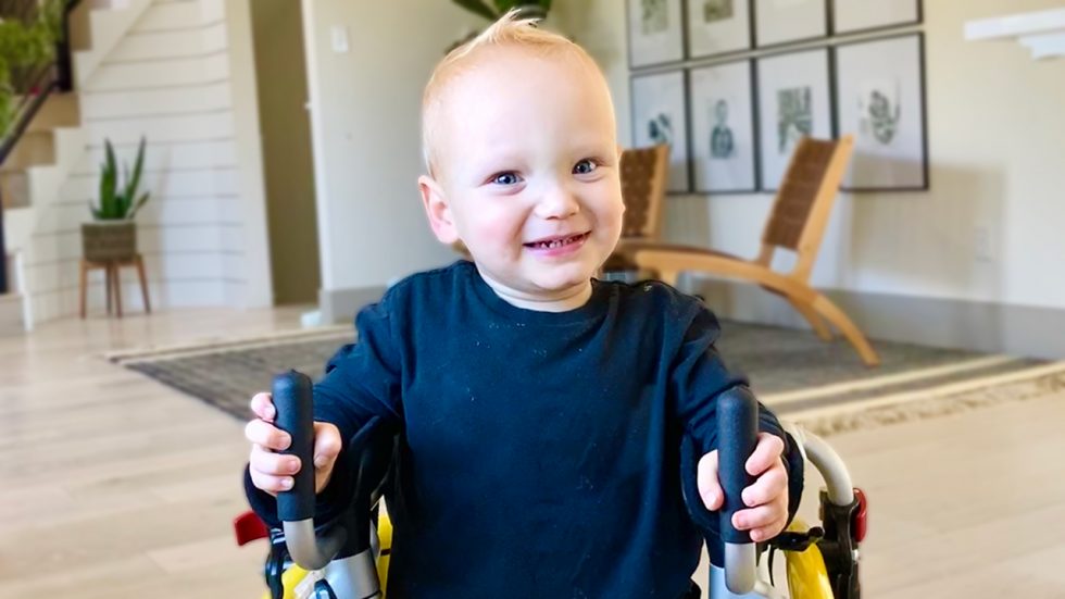 Fetal Surgery for Myelomeningocele: Liam's Story
